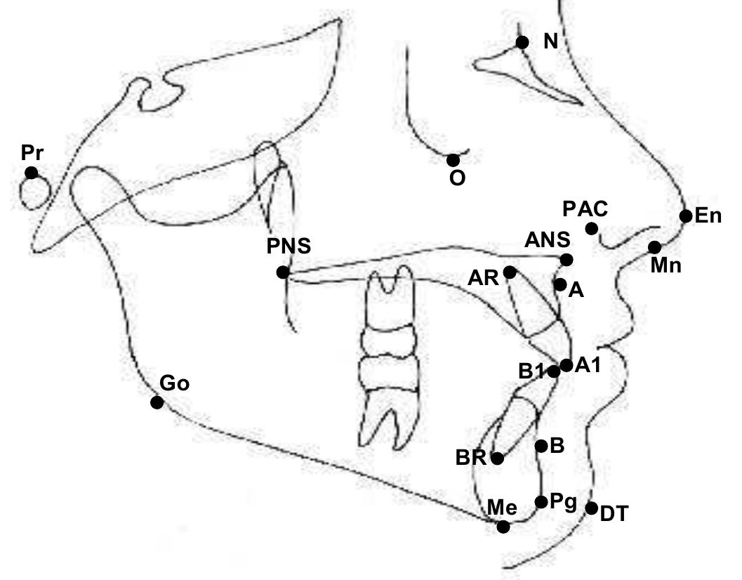 Cephalometric points.
