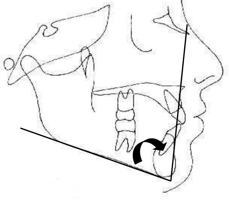 Figure 3 - from Young H. Kim Cephalometric Analytic