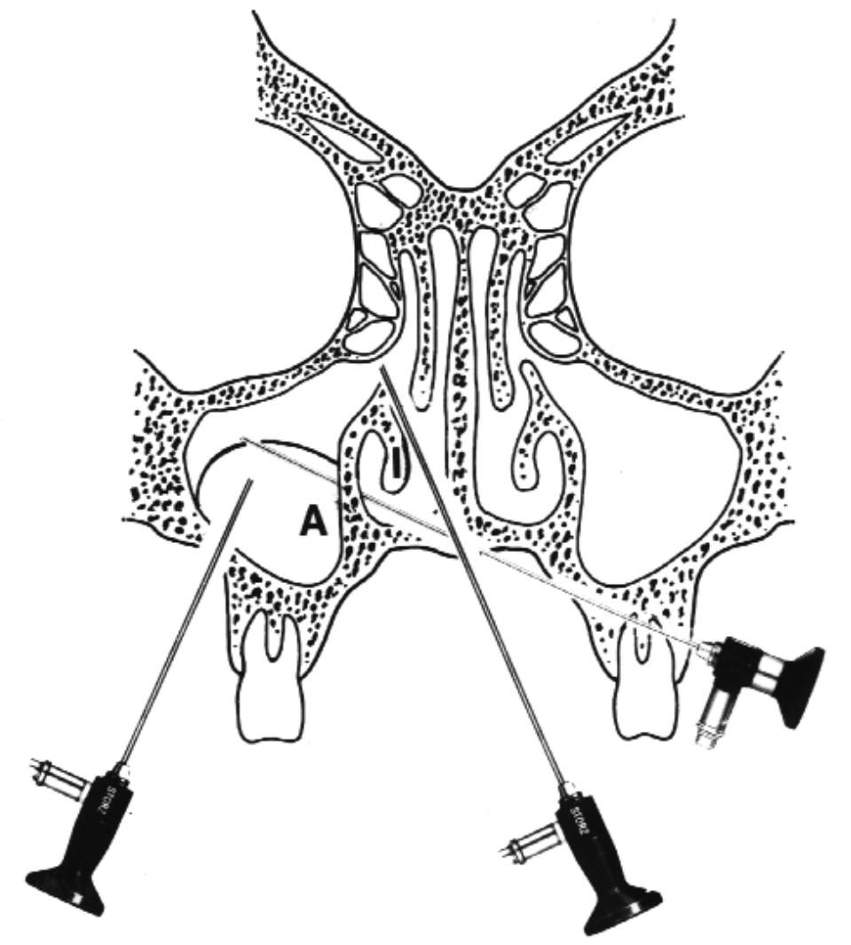 Figure 1 - from BRITISH JOURNAL OF ORAL & MAXILLOFACIAL