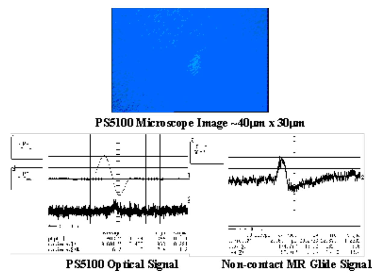 Photograph with optical signals and mr glide signal from a