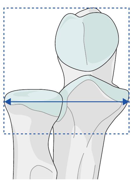 (PDF) Fracture and Dislocation Classification Compendium—2018 ...
