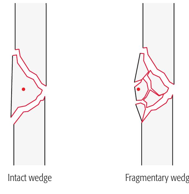 (PDF) Fracture and Dislocation Classification Compendium—2018 ...