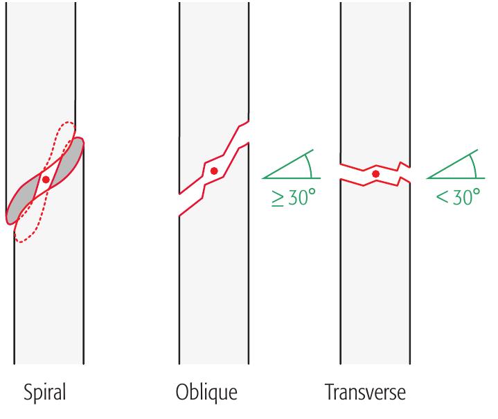 (PDF) Fracture and Dislocation Classification Compendium—2018 ...