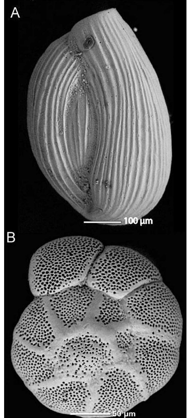 Examples of representative foraminifera types. (a) miliolid