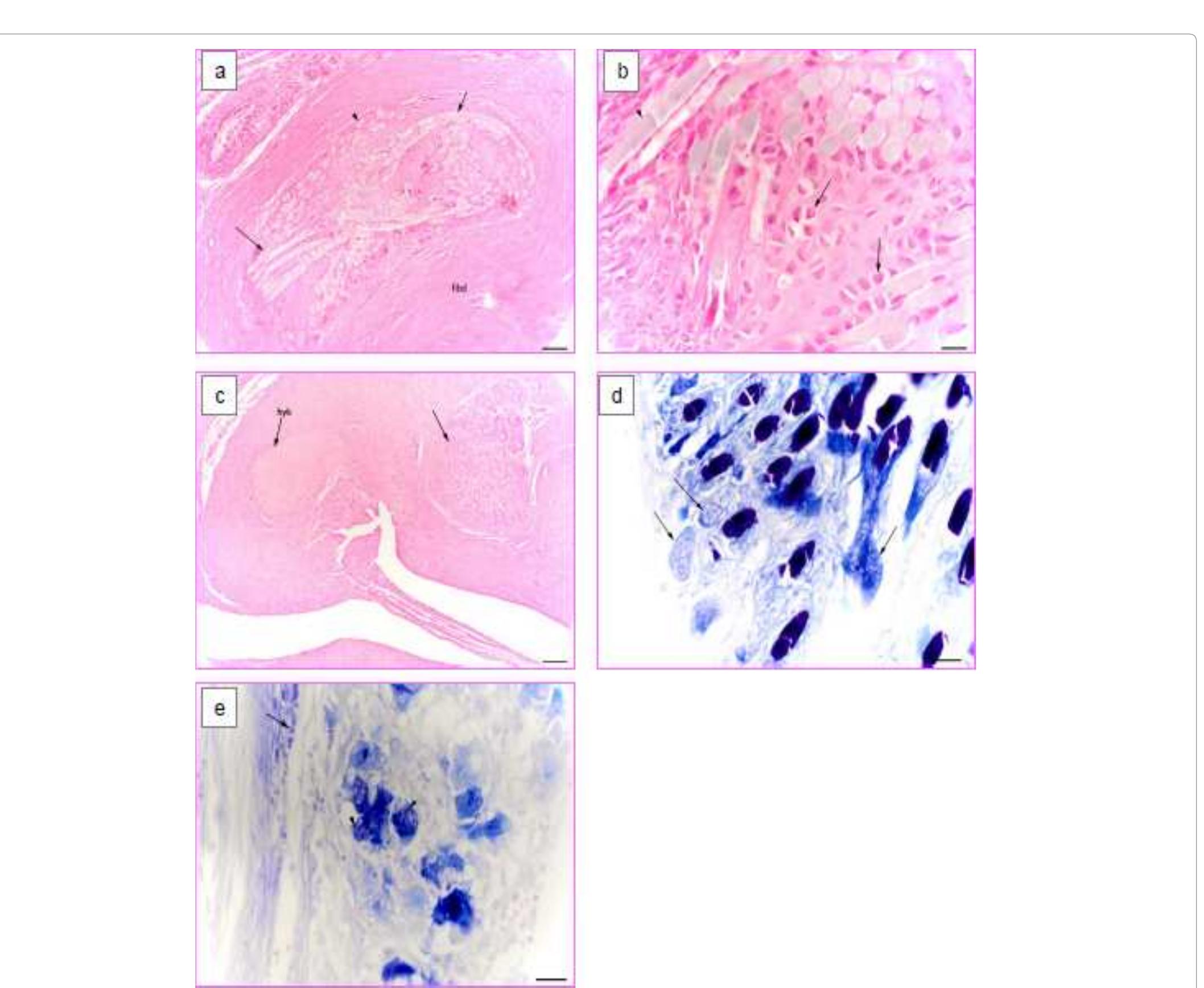 Tissue engineered (cell-seeded) meniscus substitute (group