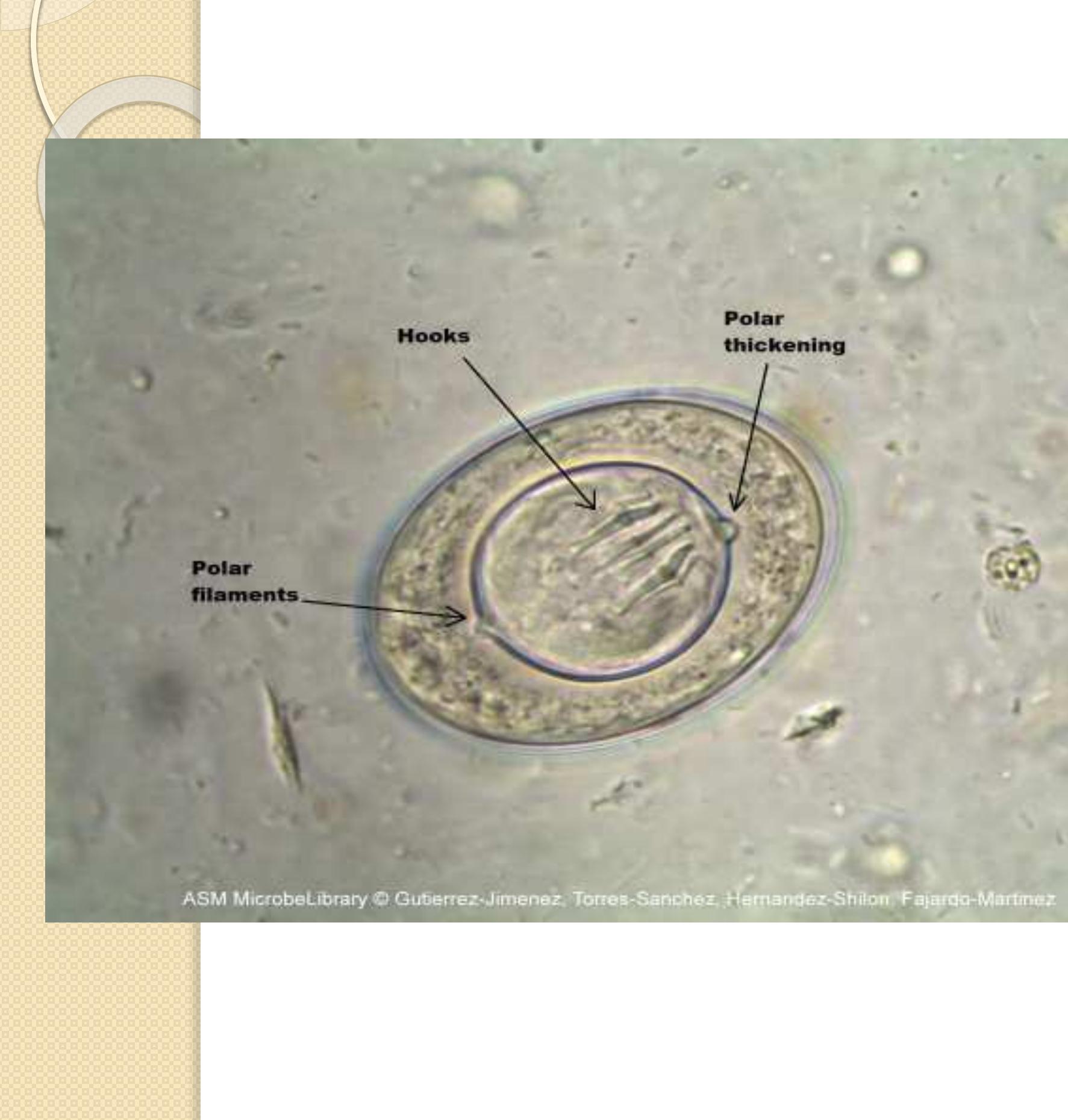 Figure 15 - PLATYHELMINTHES: Tapeworms(flukes)