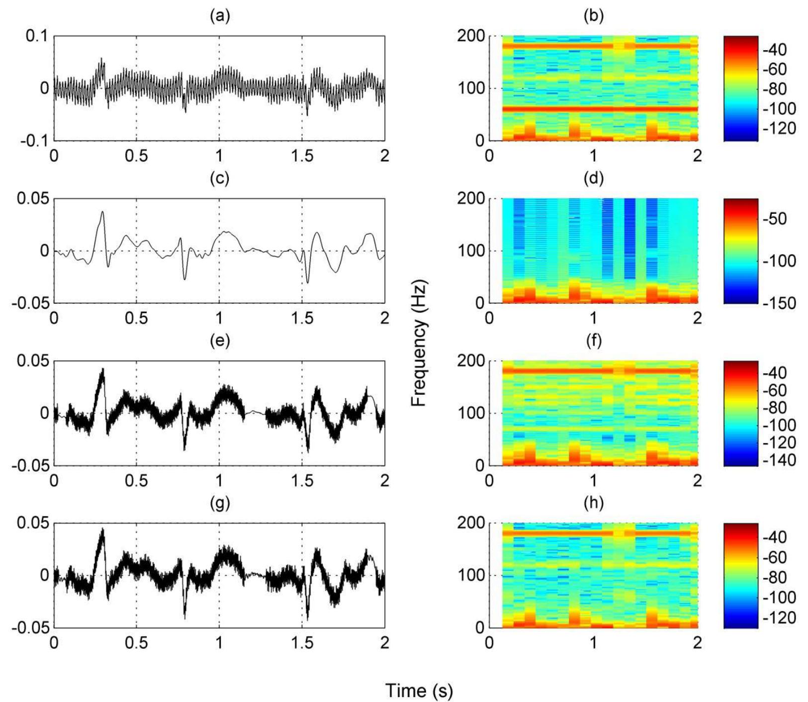 A Raw Ecg Record 1105115 And B Its Spectrogram Denoised