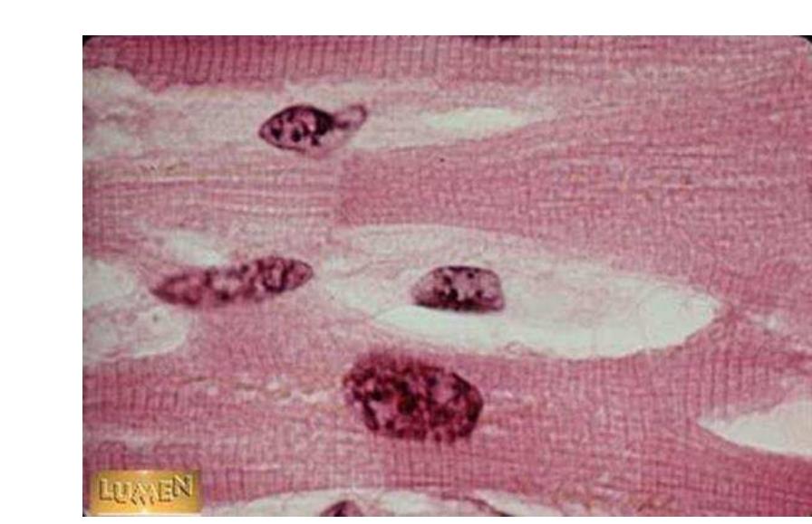 Endocardio y miocardio