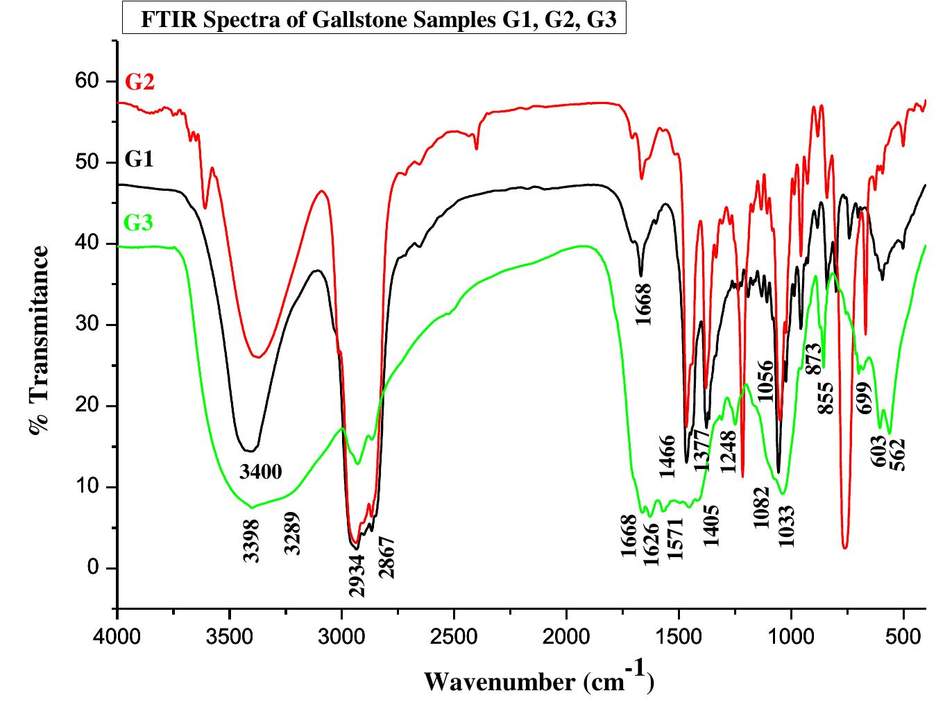 Figure 2 - from Analysis of heterogeneous gallstones using
