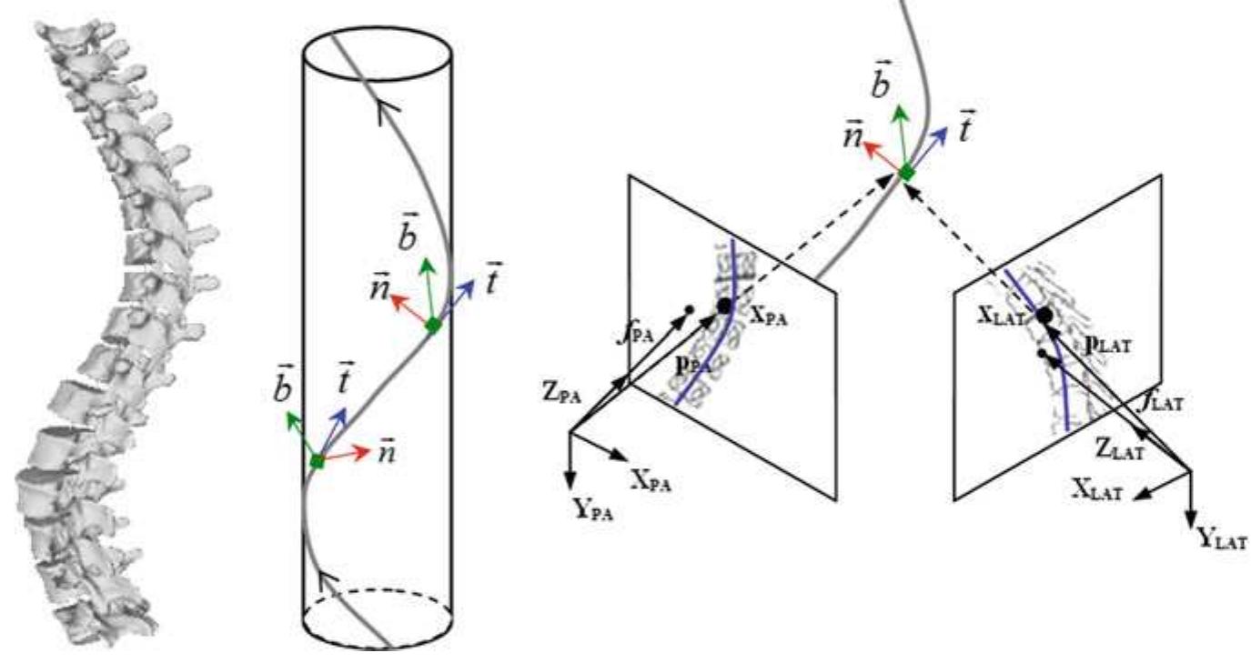 The scoliotic spine represented as a helical line which can