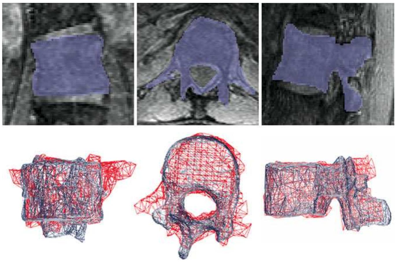 Corresponding segmented cuts from mri scans, along with 3d