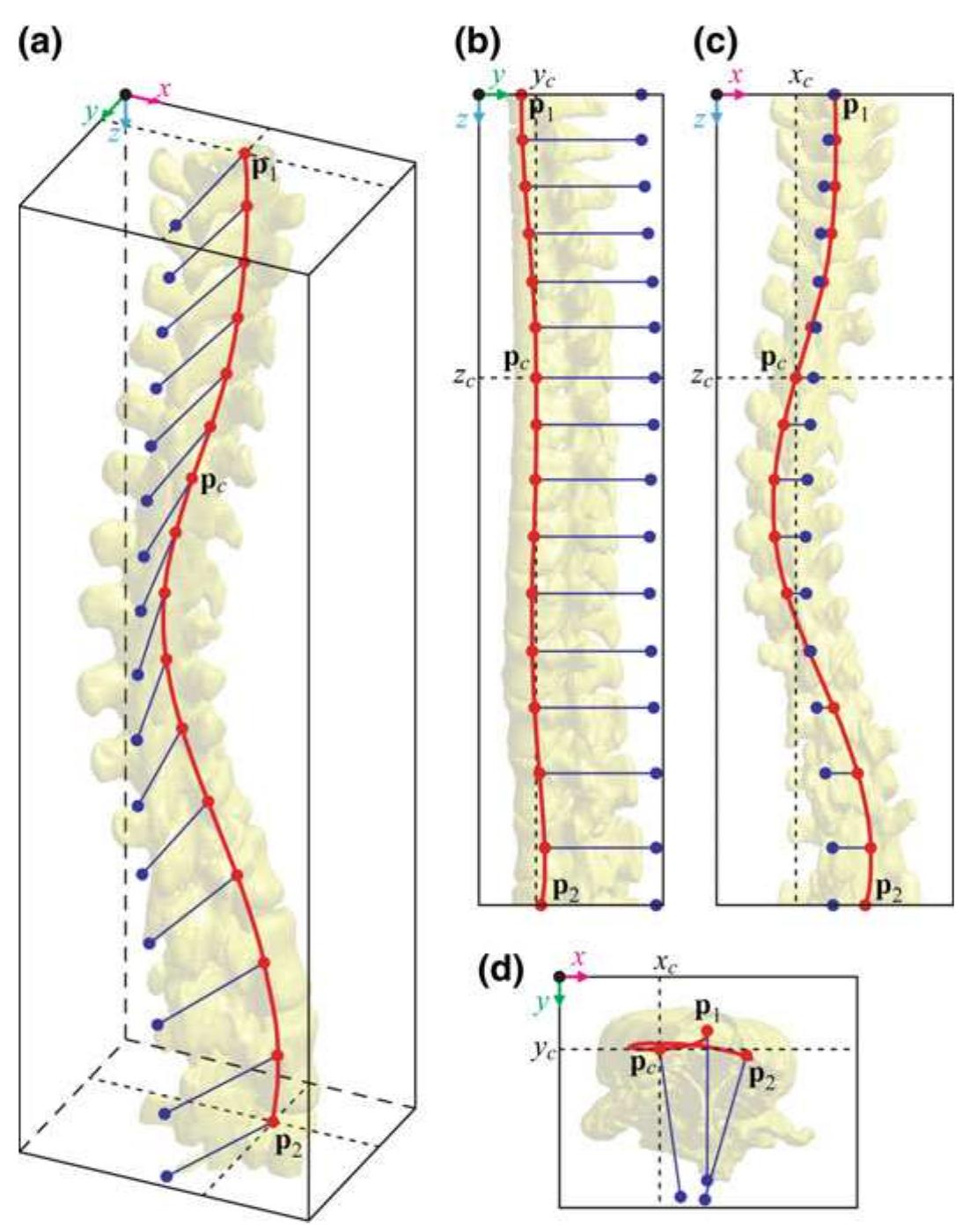 The spine curve (red line) and axial vertebral rotation