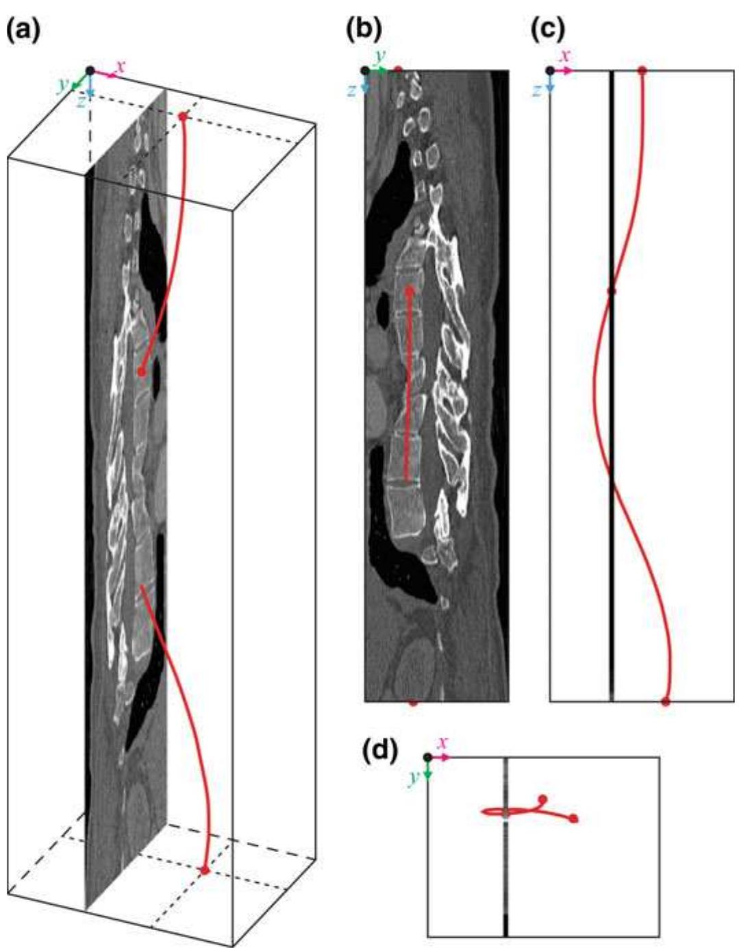 A sagittal orthogonal multi-planar cross-section m,—,, of a