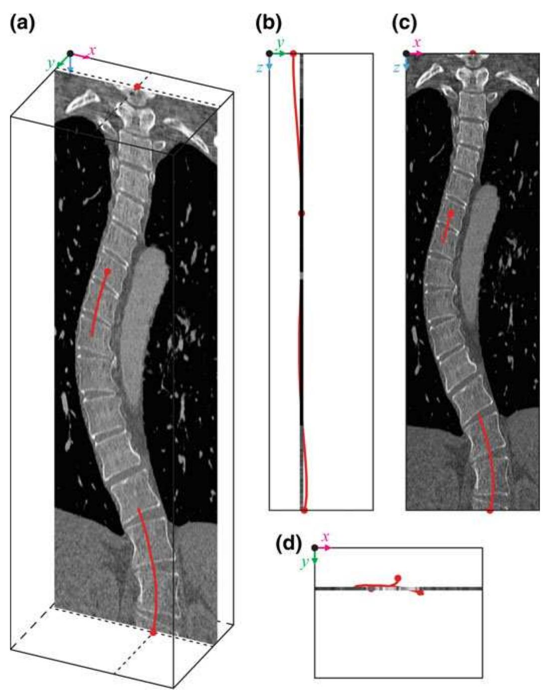 A coronal orthogonal multi-planar cross-section my_,, of a