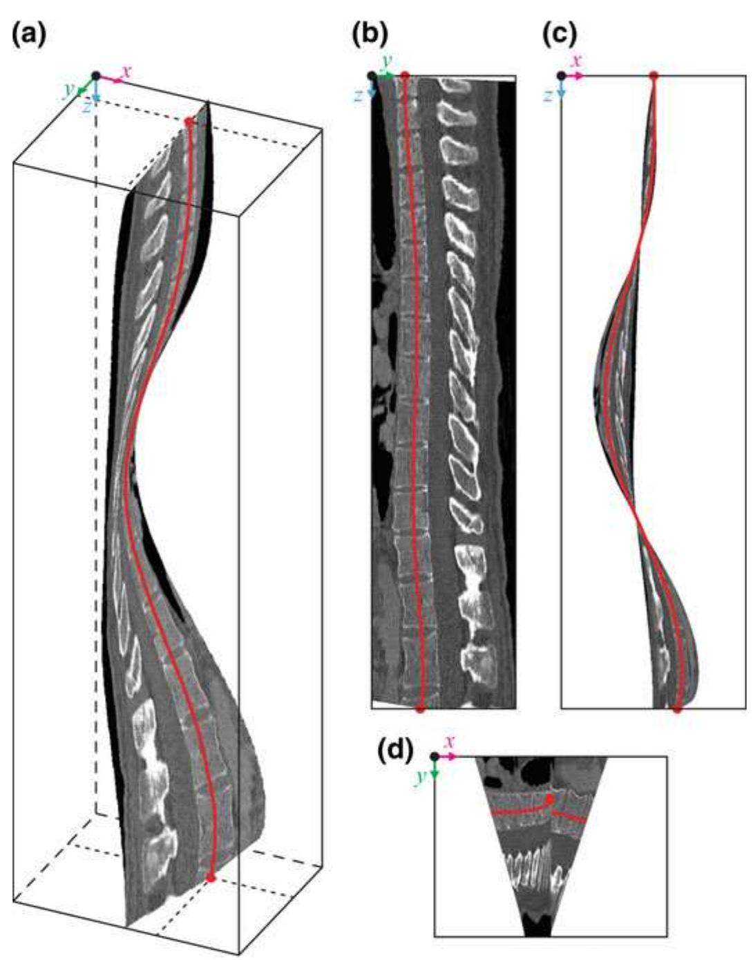 A sagittal orthogonal curved-planar cross-section c,—,, of a
