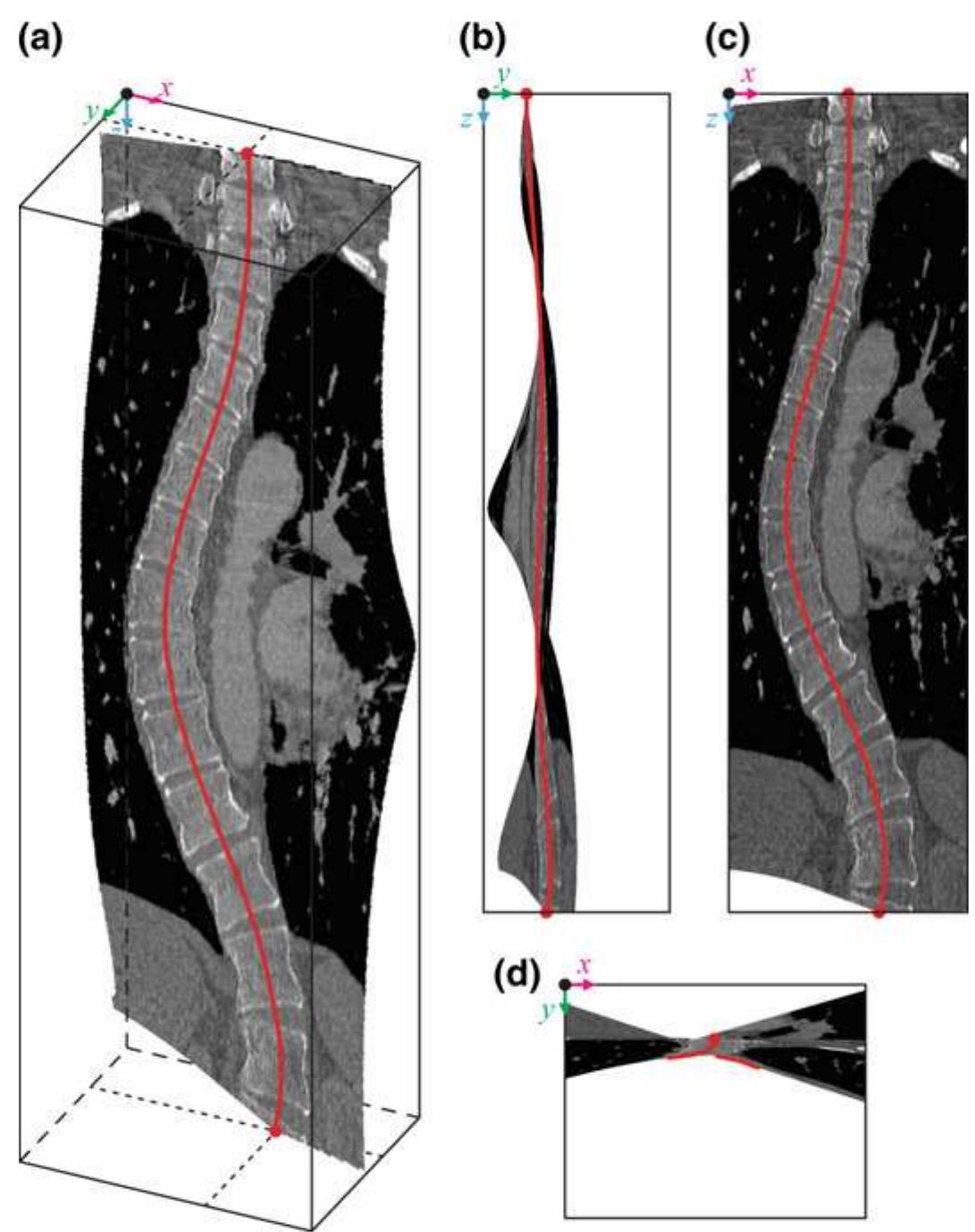 A coronal orthogonal curved-planar cross-section c,=), of a
