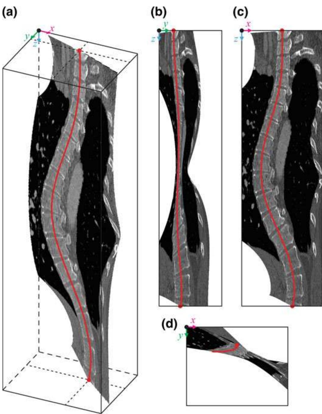 A coronal oblique curved-planar cross-section cr=v..6=$, of