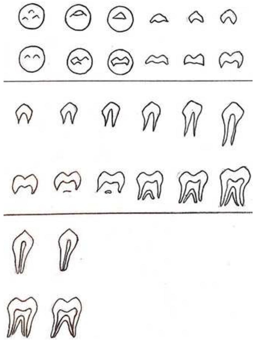 Schematic diagrams of the 14 dental development stages