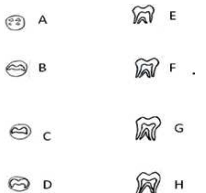 Schematic representation of the demirjian, goldstein and