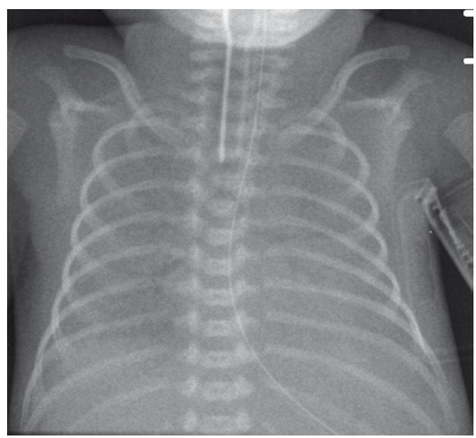 Figure 3 - Handbook of pediatric surgery