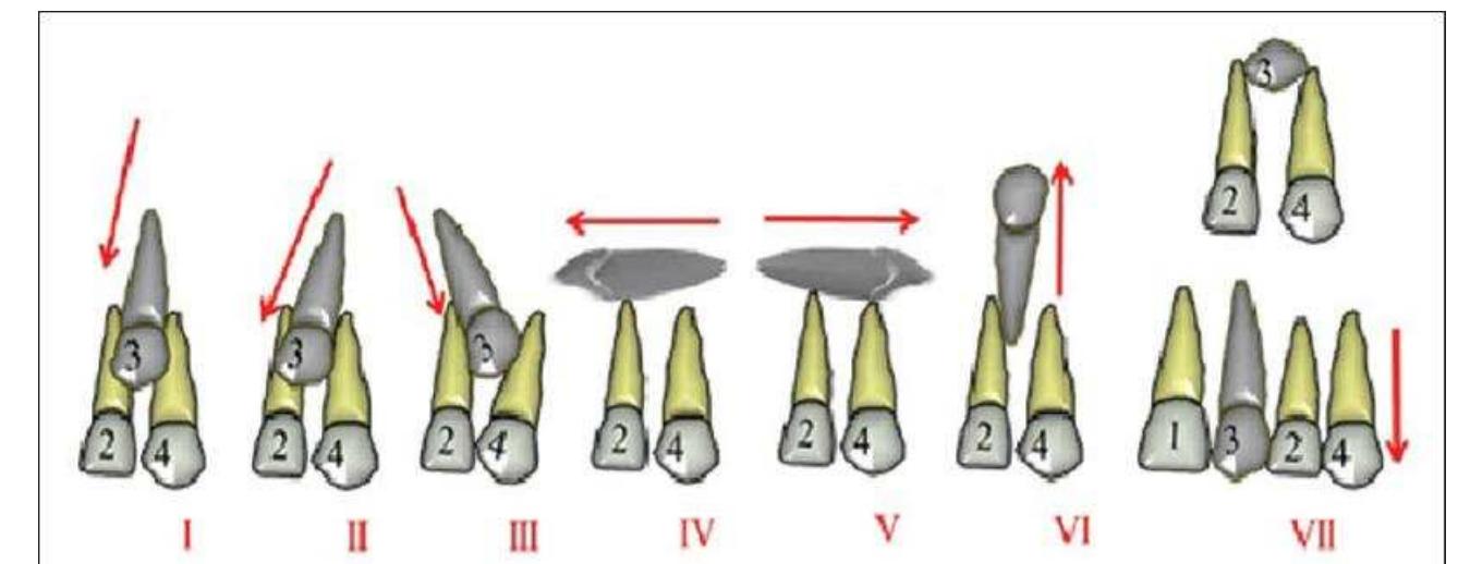 Schematic representation of the classification system of
