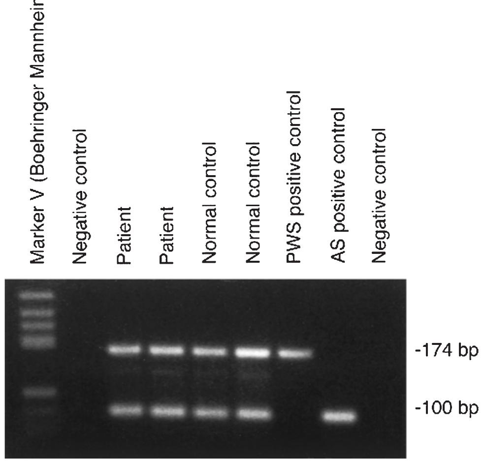 Figure 16 - Management of prader-willi syndrome