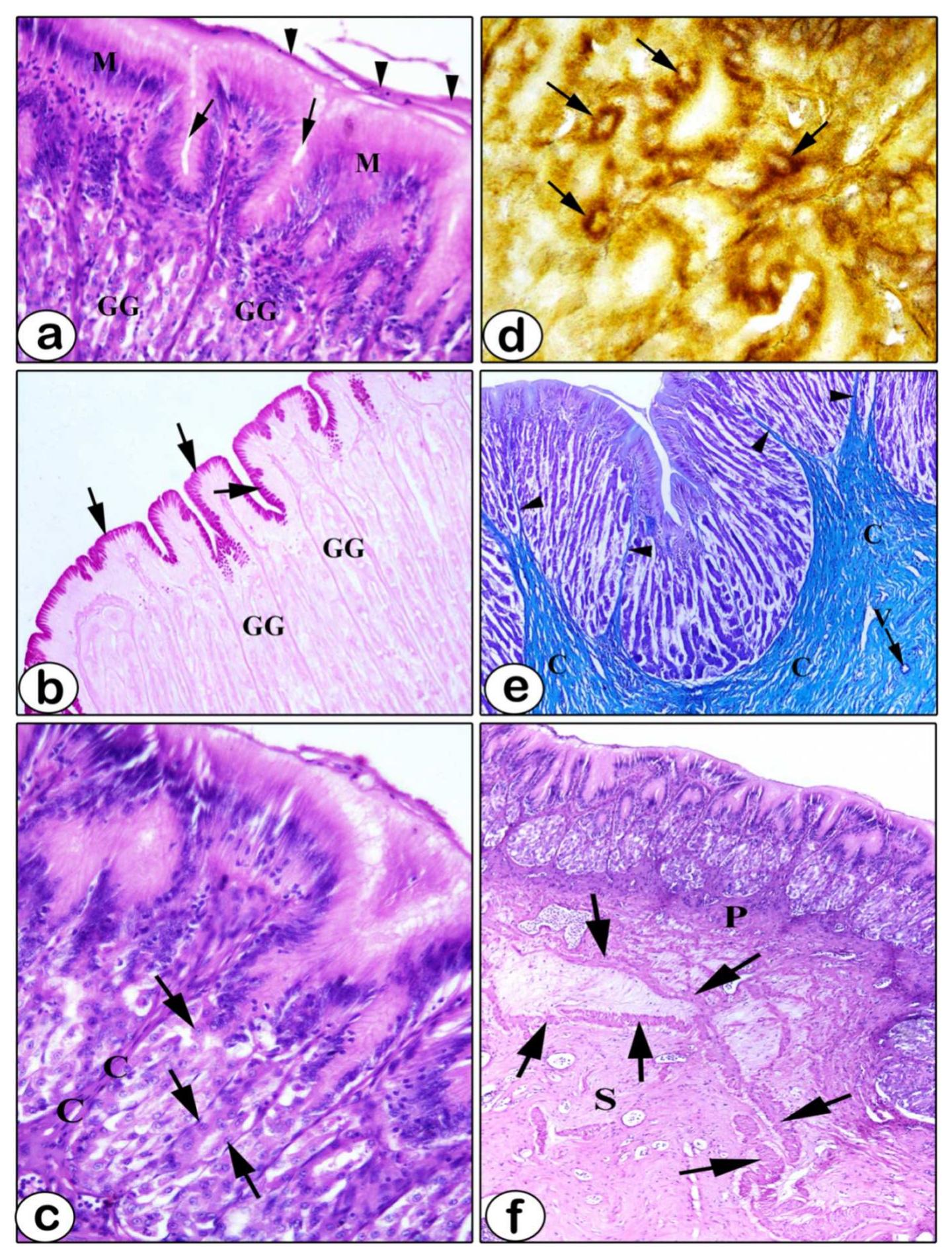 Light photomicrographs of the fundic region of african