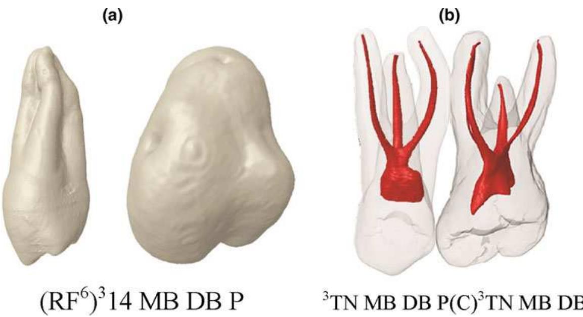Micro-ct models showing codes for root fusion (rf) and
