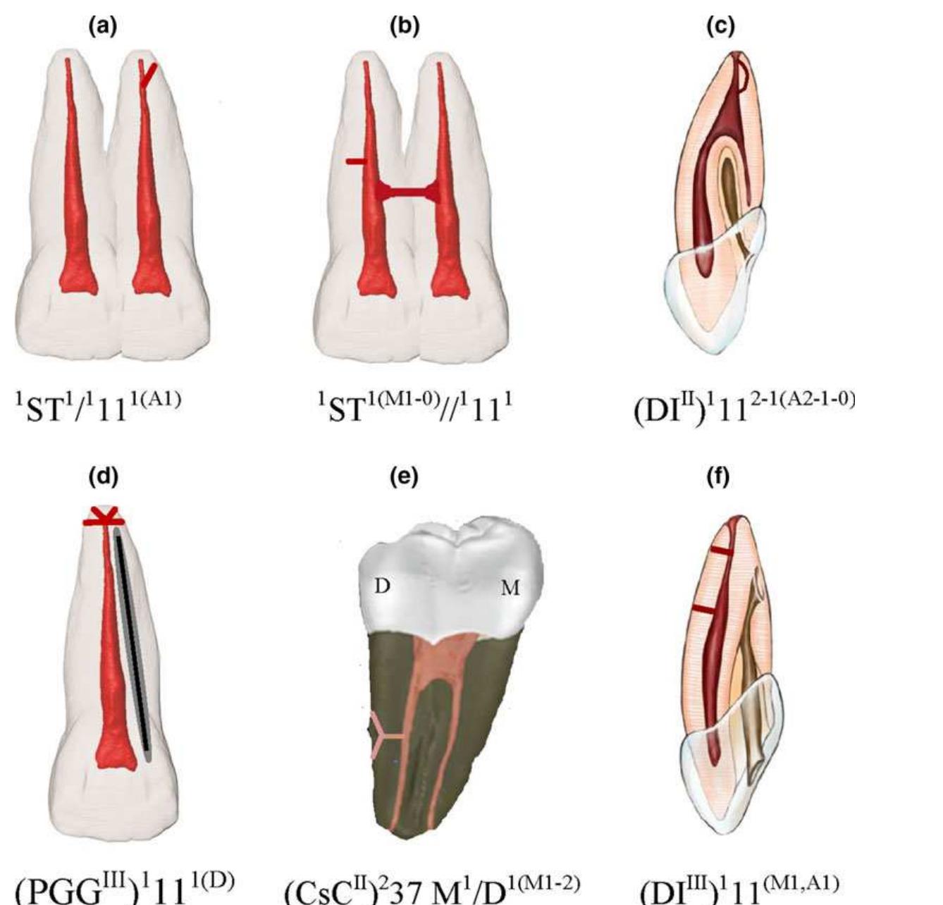 Rigure 10 drawings and micro-cl models showing the