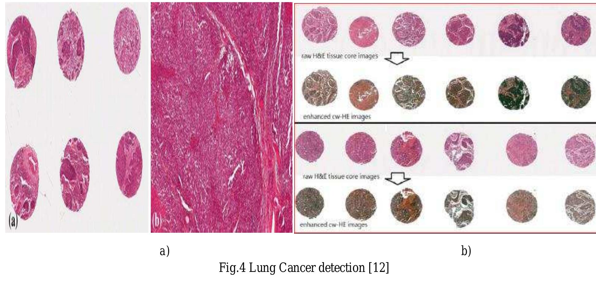 (a) presented the tissue samples shape and fig.4 ( b)
