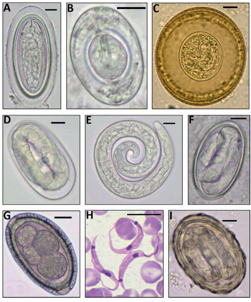 Helminth eggs and larva & the protozoan blood parasite found