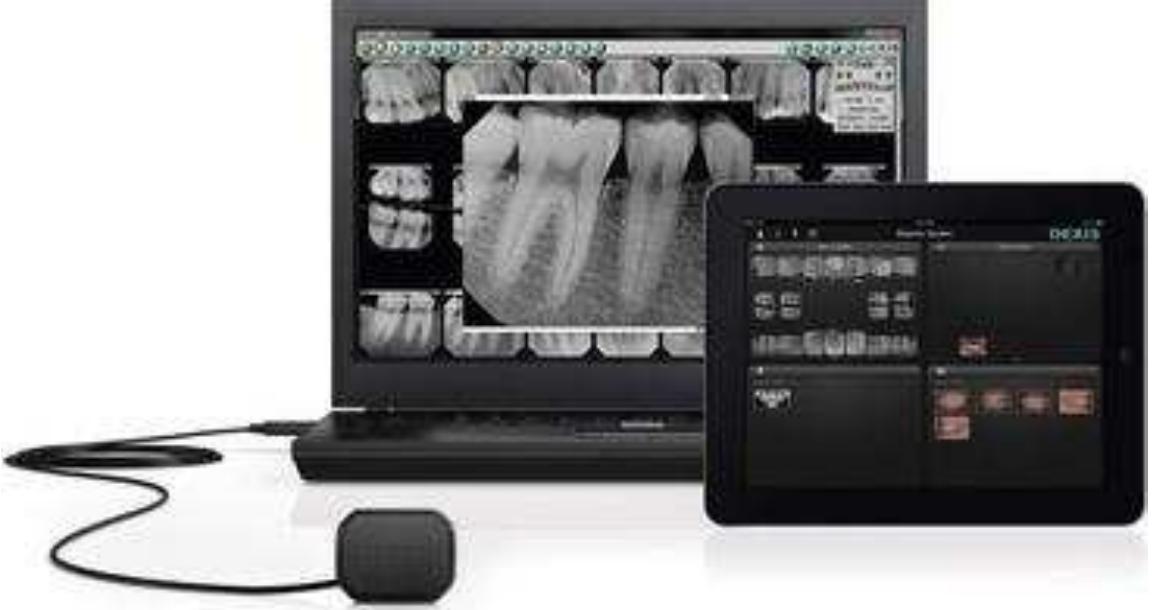 - digital radiographic system includes digital sensor and