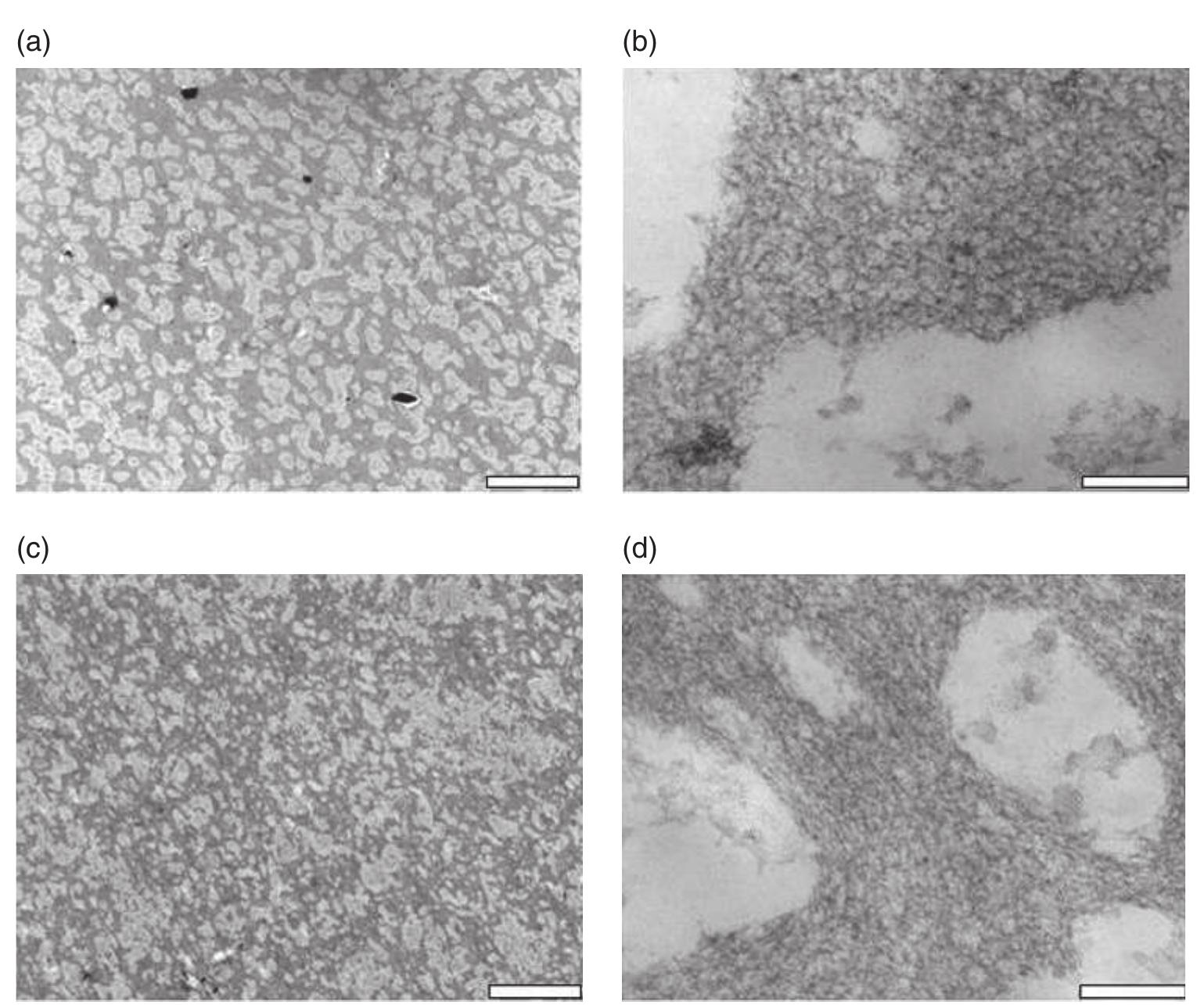 7 microstructure of composite gels of sugar, starch and