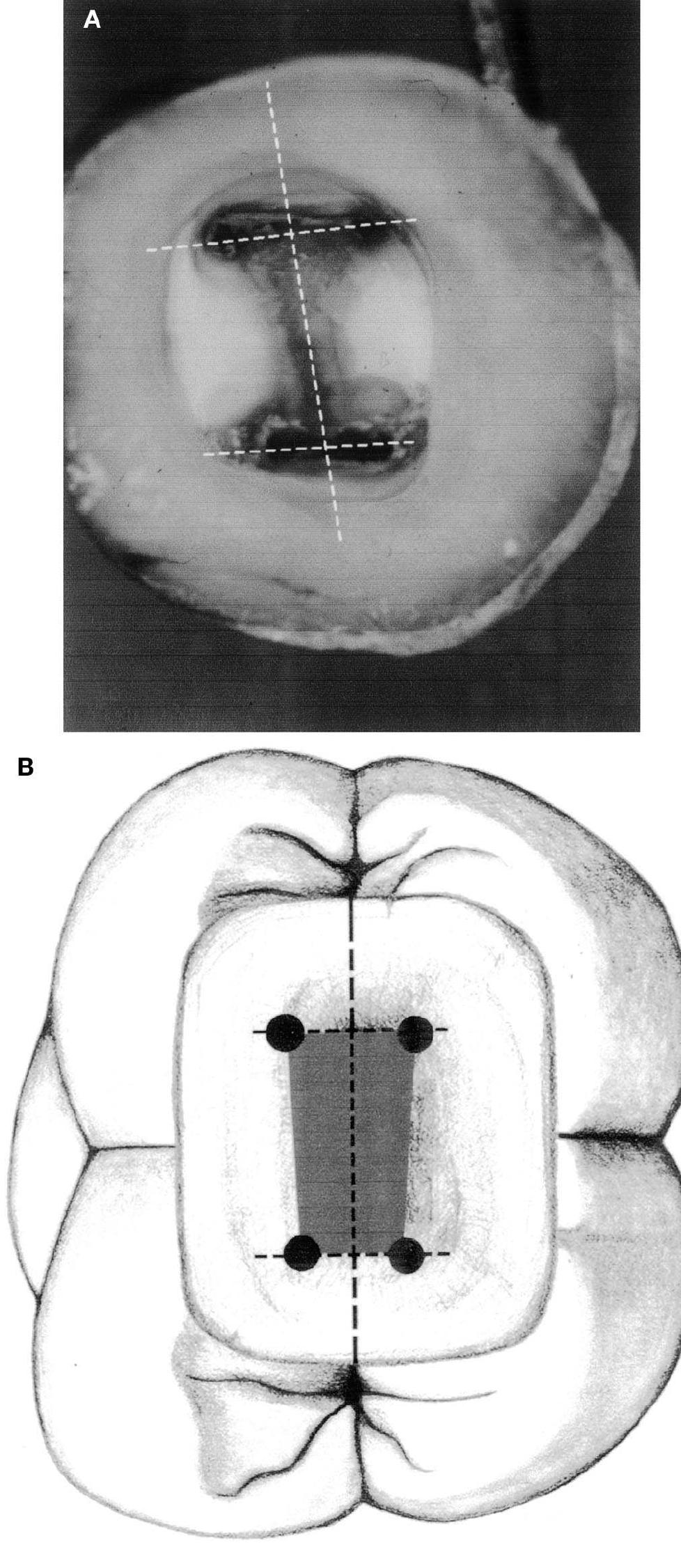 Figure 10 - Anatomy of the Pulp-Chamber Floor
