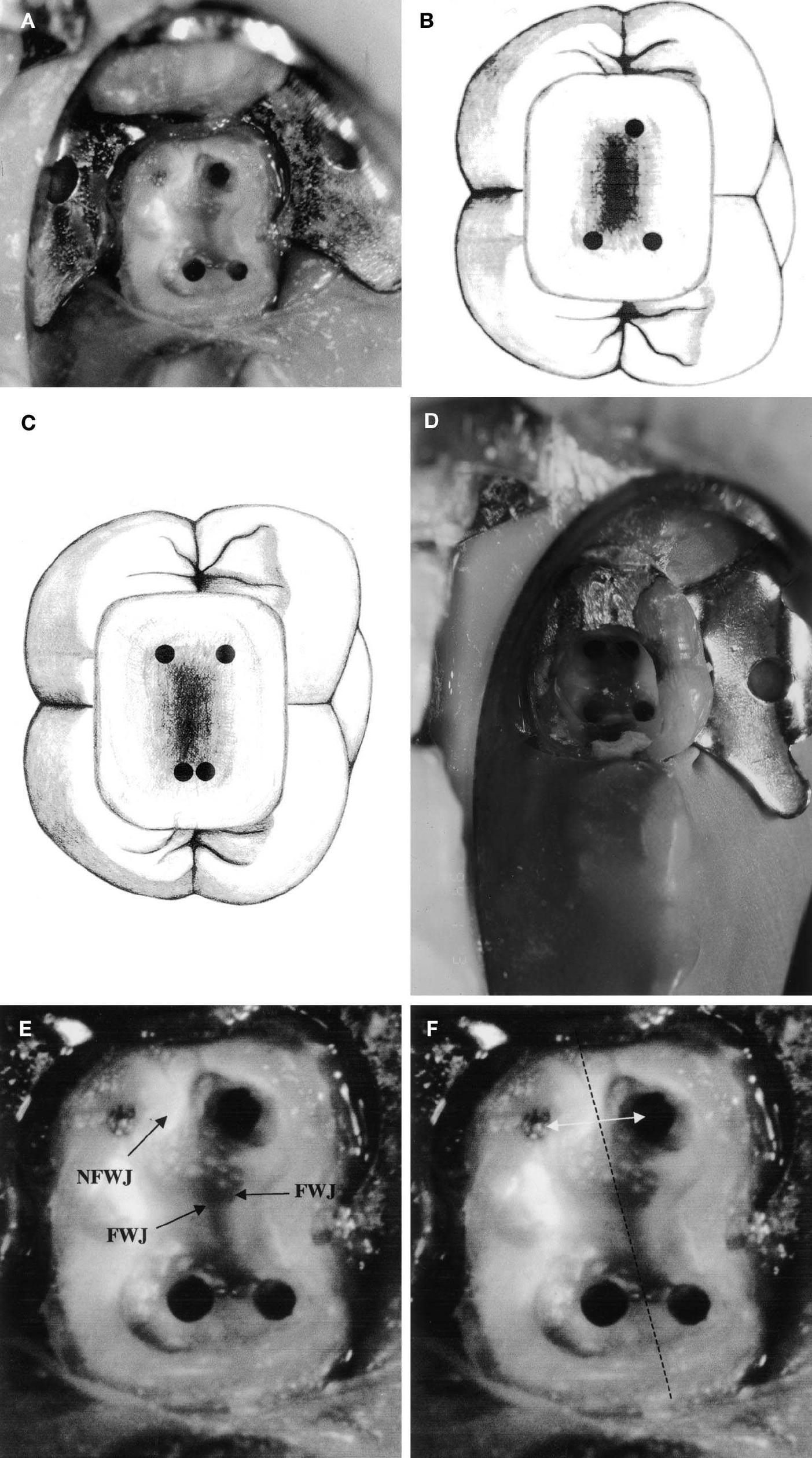 Fia 15. (a) cut specimen with pulp-chamber-floor anatomy