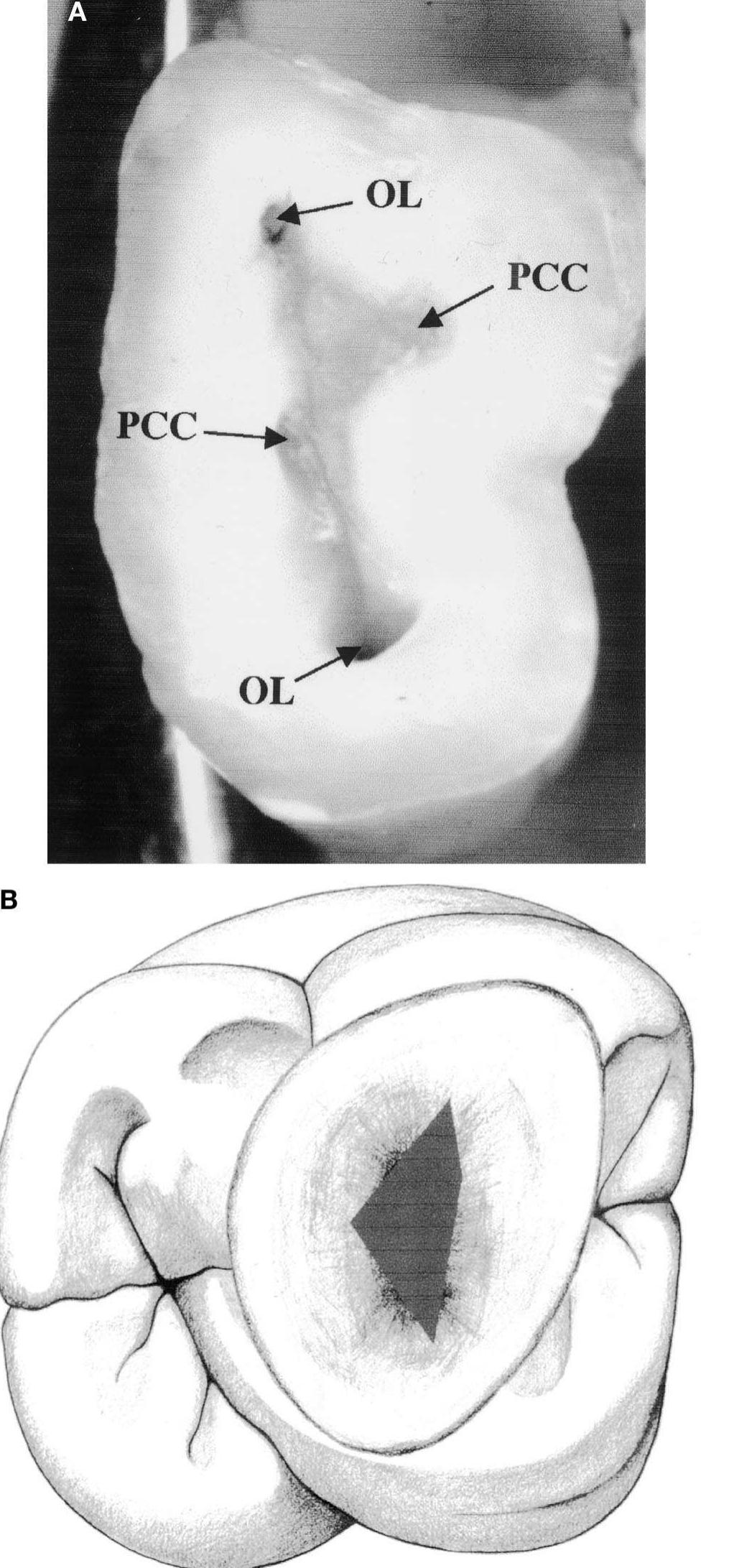 Figure 16 - Anatomy of the Pulp-Chamber Floor