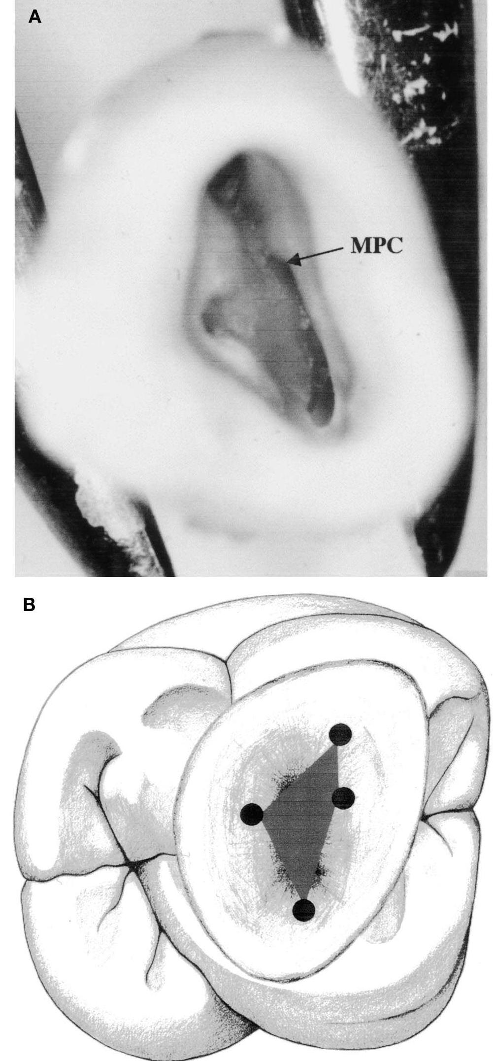 Figure 17 - Anatomy of the Pulp-Chamber Floor