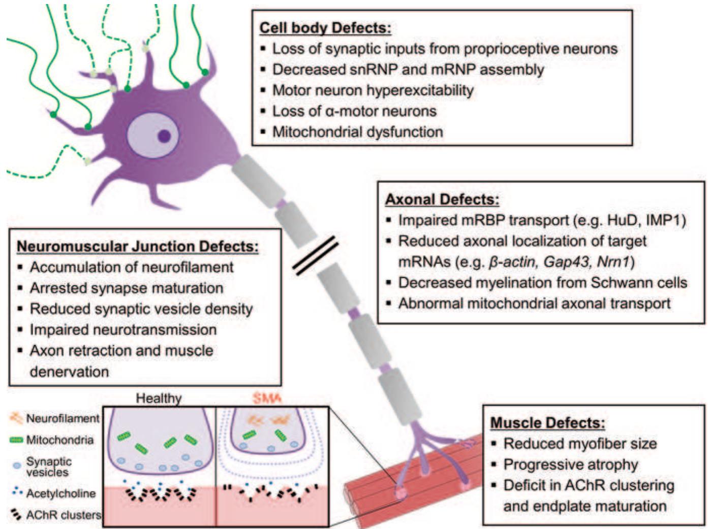 1 cellular defects in sma motor neurons. schematic of a