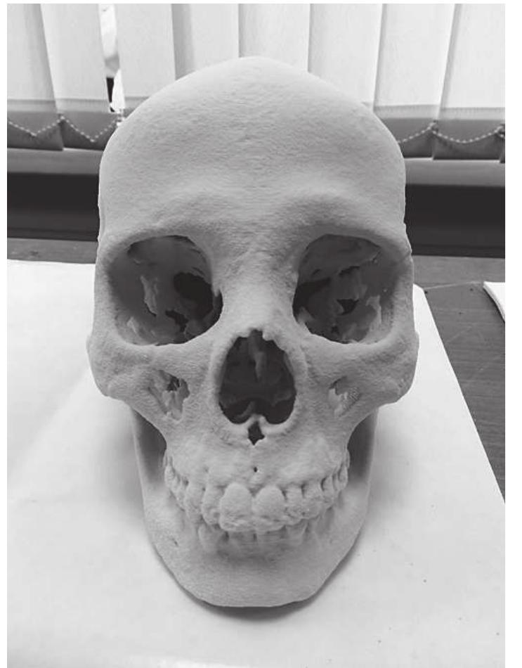 Example of 3d lithography reconstruction of the skull shape