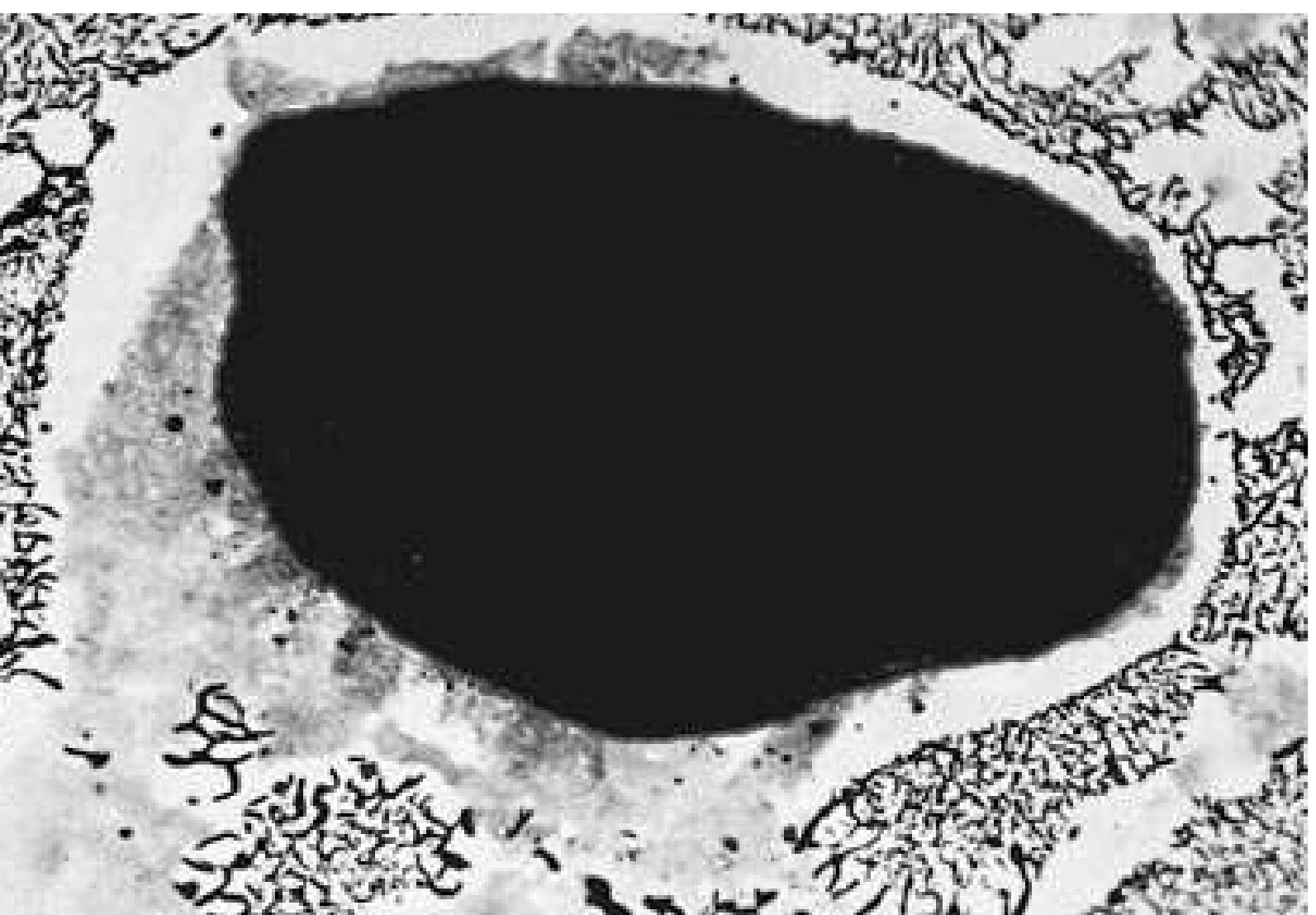 (PDF) Casting Defect - Pinholes