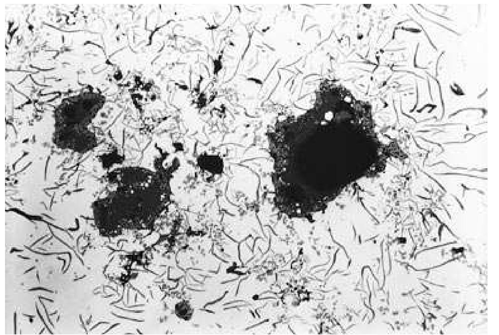 (PDF) Casting Defect - Pinholes