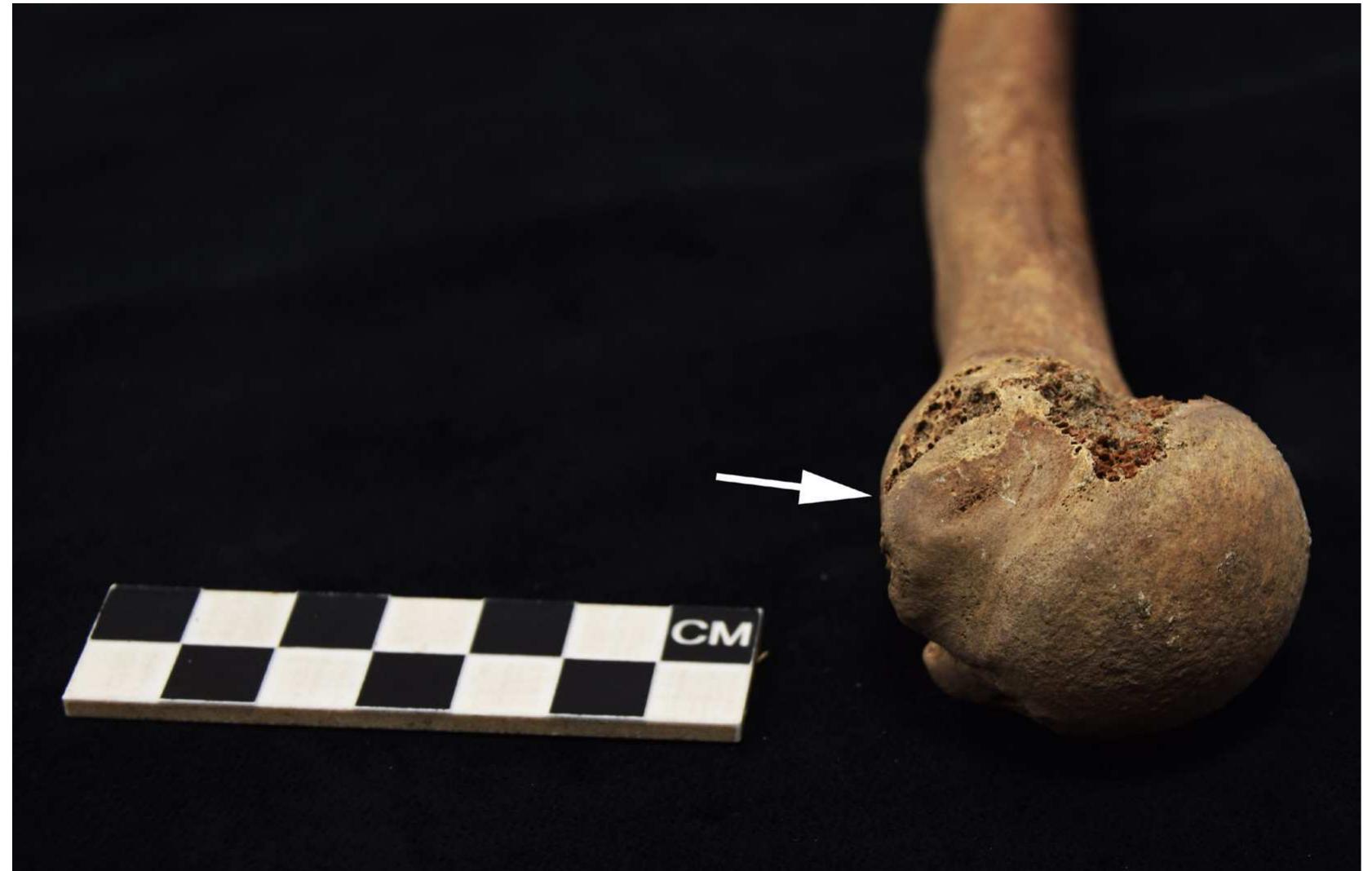 A2. superior posterior view of r proximal humerus. r
