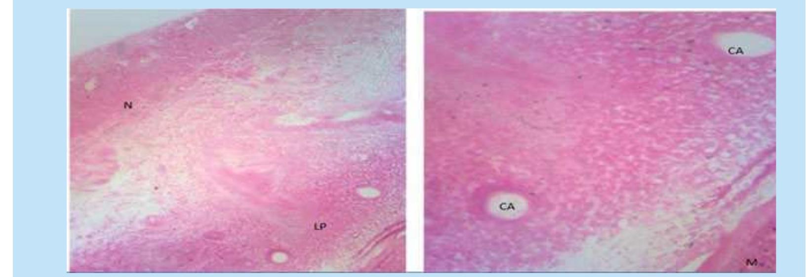 Group f uterus showing n: normal mucosa, lp: lamina propria,