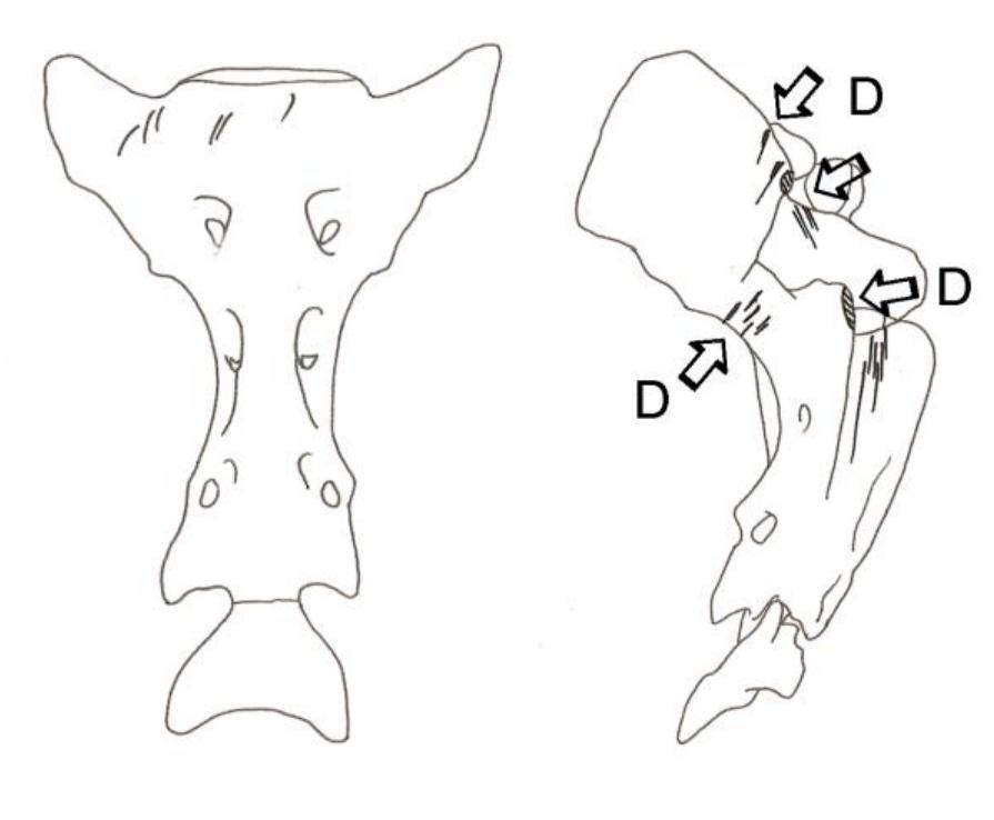 Sacrum. ut marks on the sacrum and the pelvis (fig. 131 and