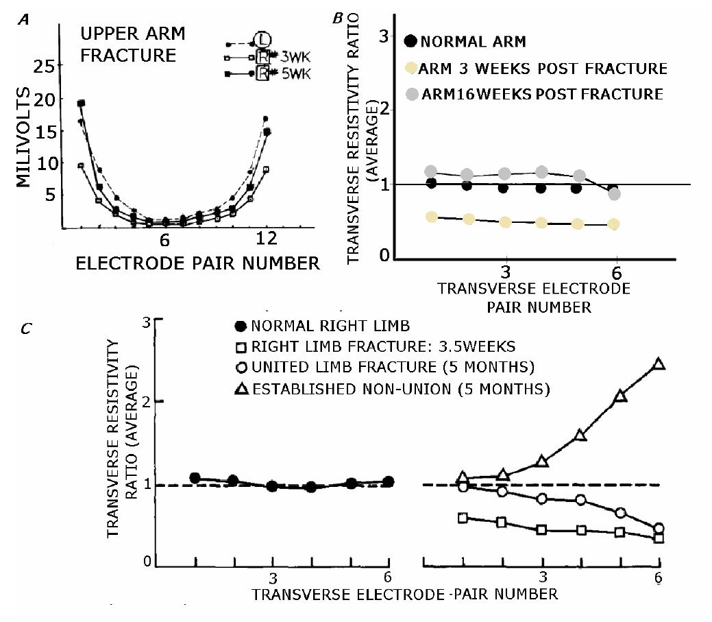 Figure 3 - from Bone Electrical Impedance and Tomographic