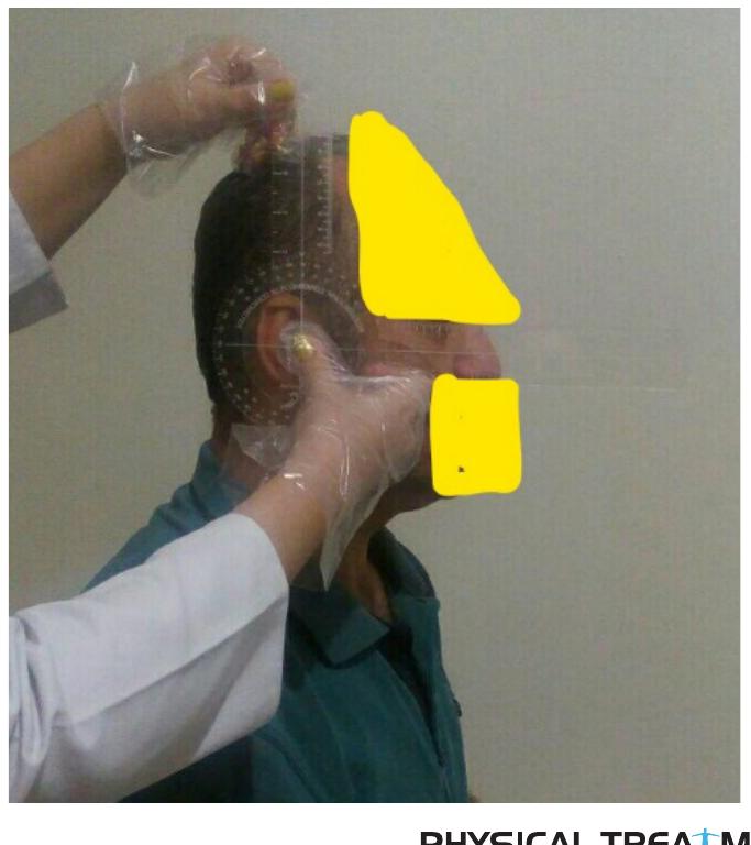 Measuring cervical flexion and extension.