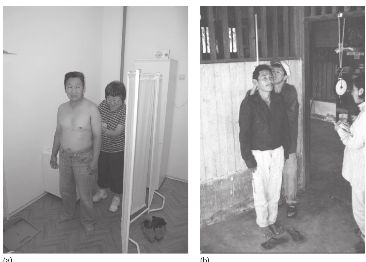 Comparison of body weight and morphology in adult men from