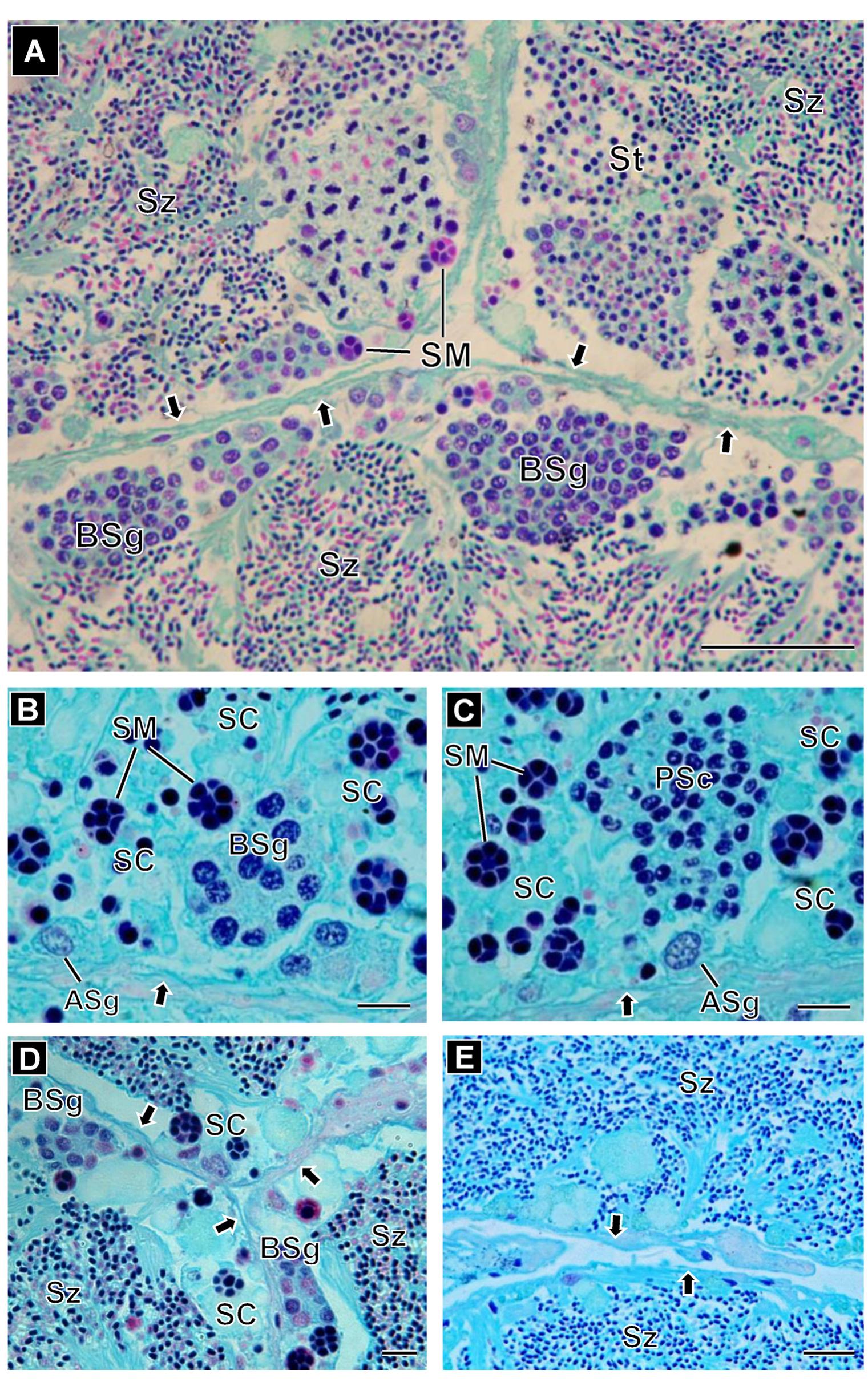 Or two electron-dense nucleoli (fig. 3a). type a