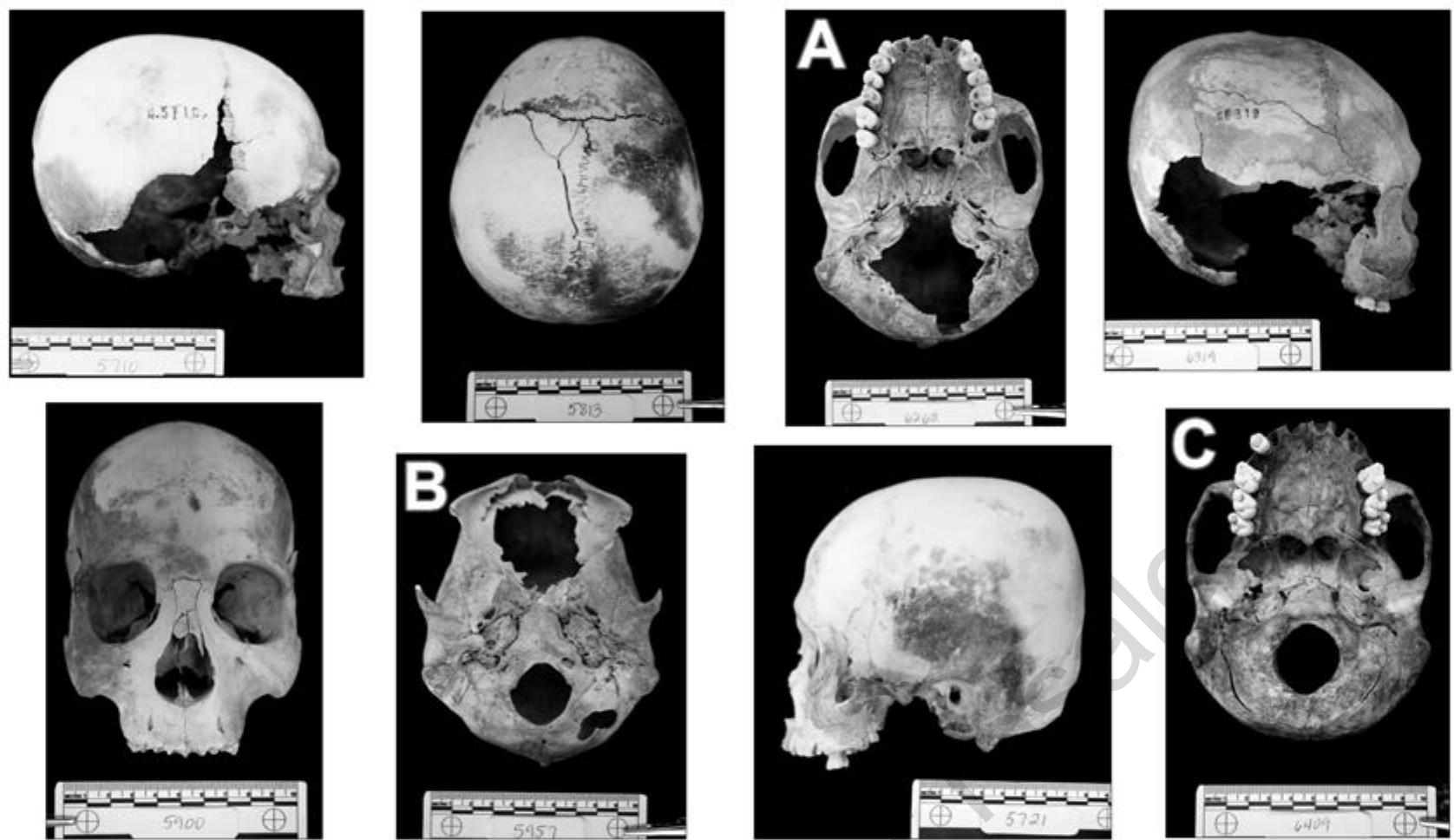 Figure 4 - Khmer Rouge Regime Massacres: Skeletal Evidence