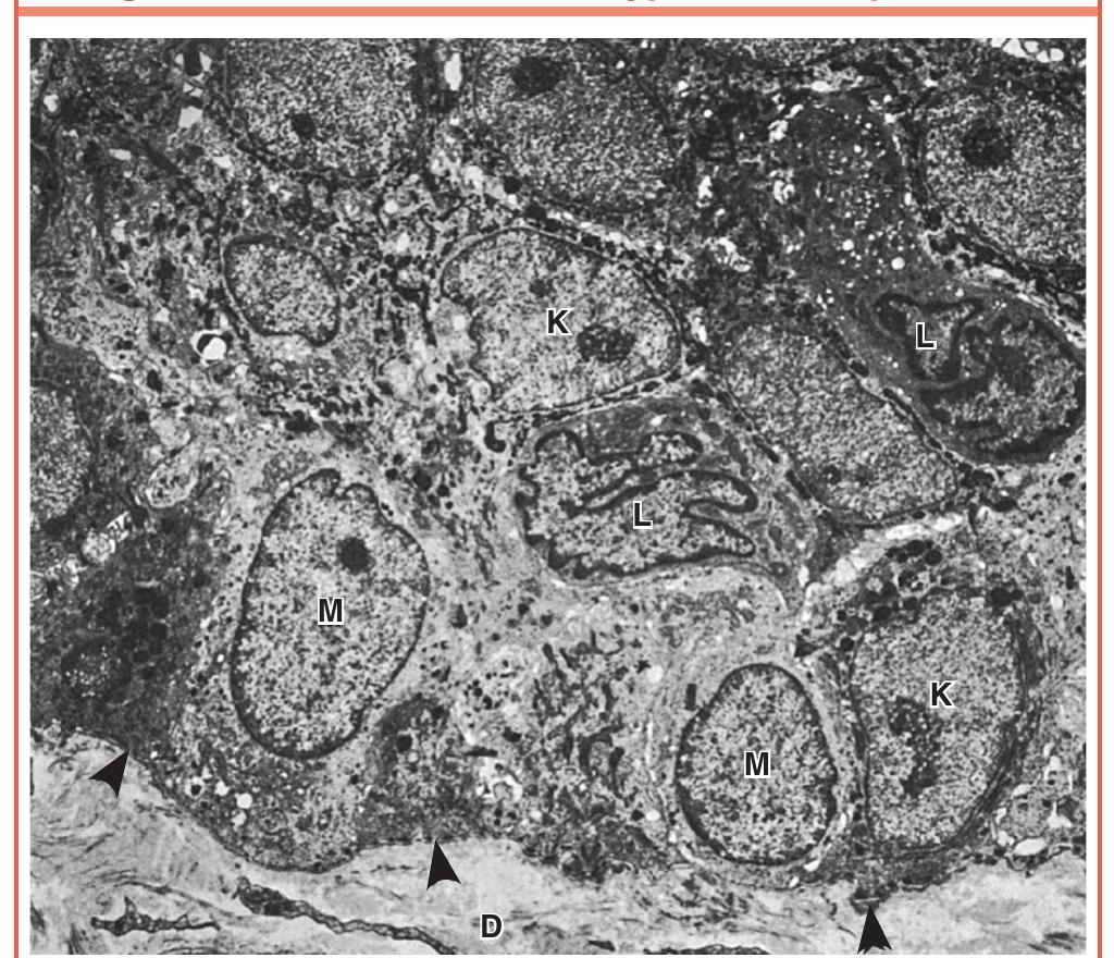 The three basic cell types in the epidermis include